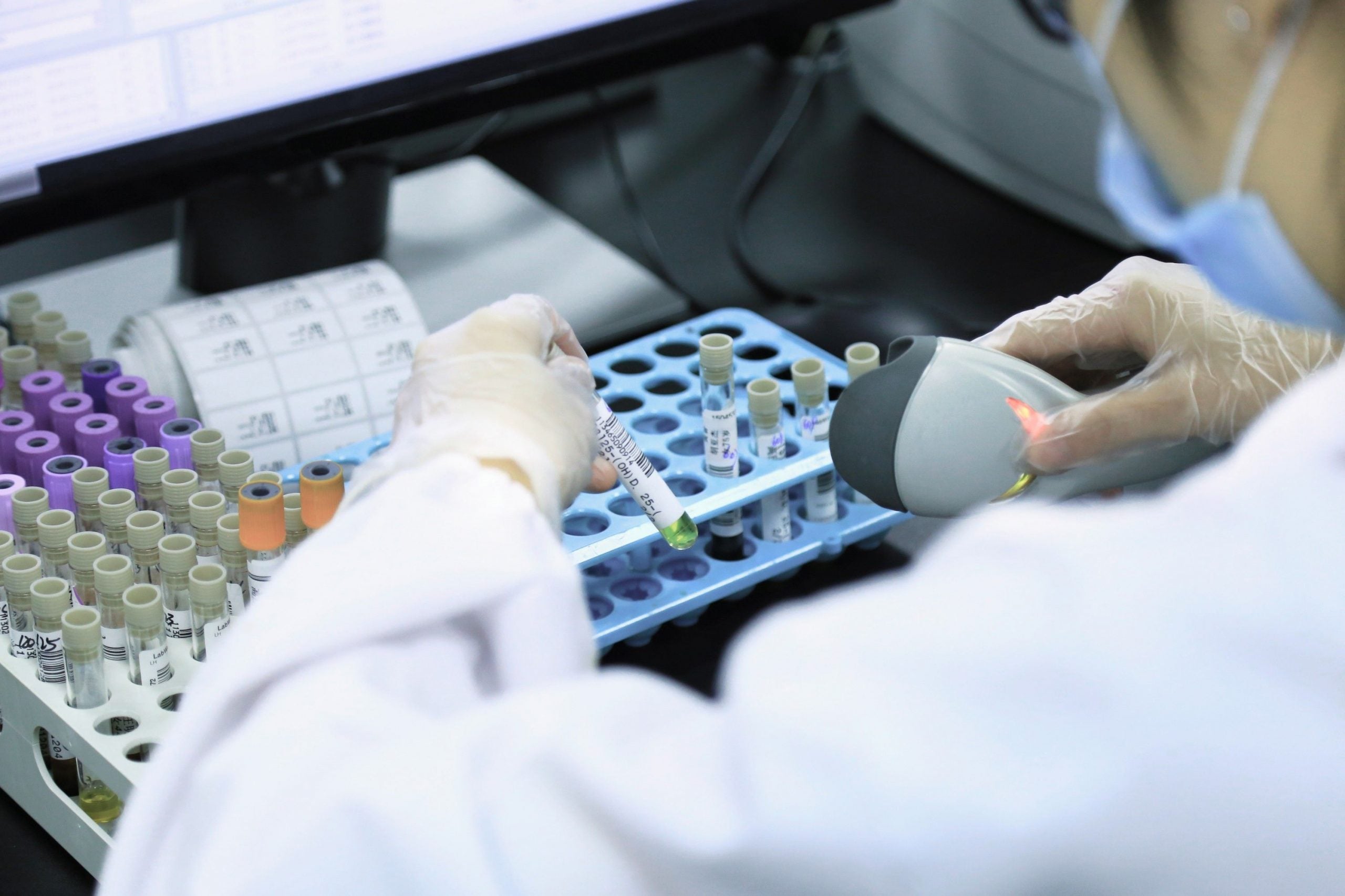 Controle de qualidade laboratorial: qual sua importância? Entenda!